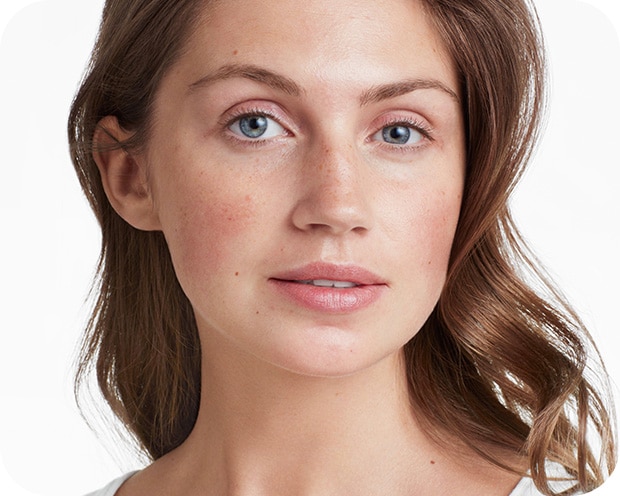 Skincare For Redness | Anti Redness Skincare | Clinique